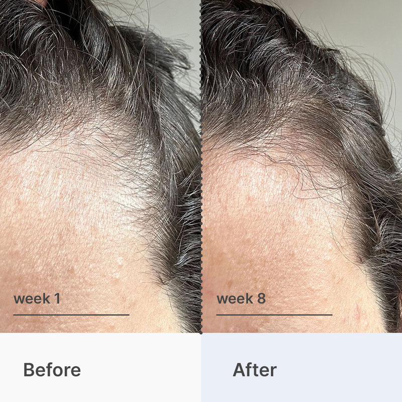 Superpower Fortifying Hair & Scalp Serum | BNY