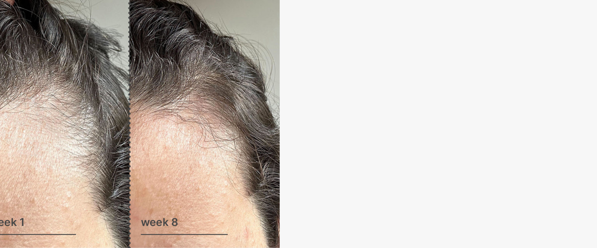 Superpower Fortifying Hair Scalp Serum | BNY