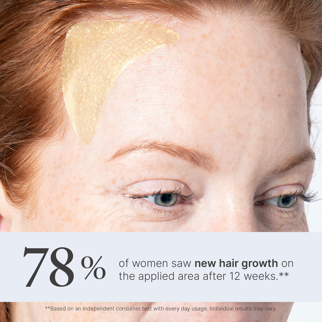 Superpower™ Thickening Hairpatches | BNY