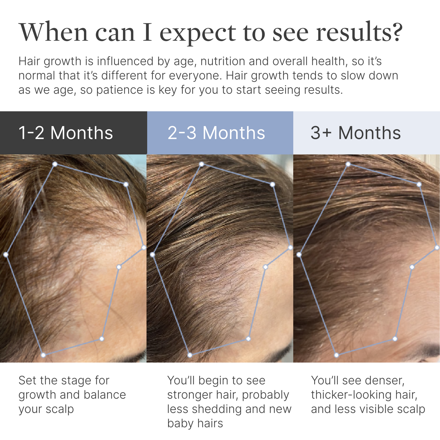 Superpower™ Thickening Hairpatches | BNY