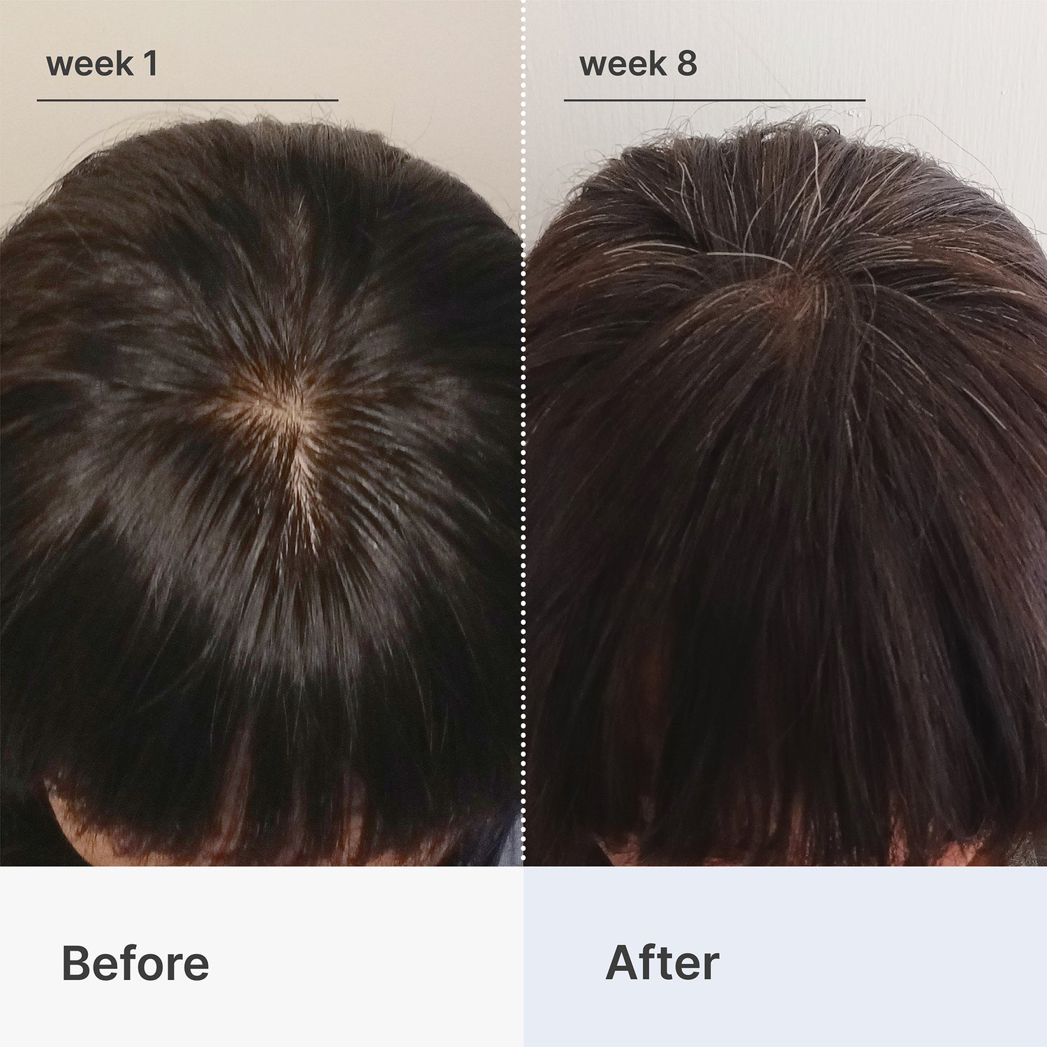 Superpower+ Advanced Hair Densifying Scalp Serum | BNY